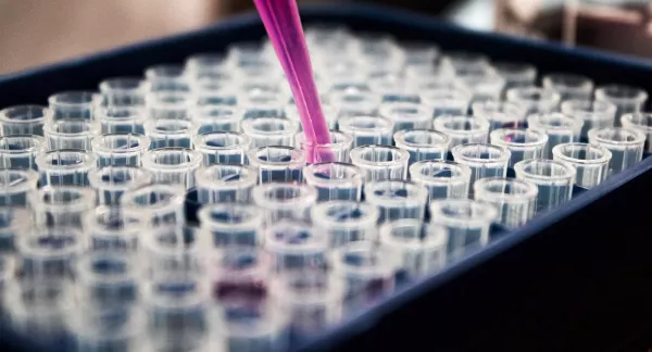 Methods for Real-Time Measurement of THMs and HAAs in Distribution ...